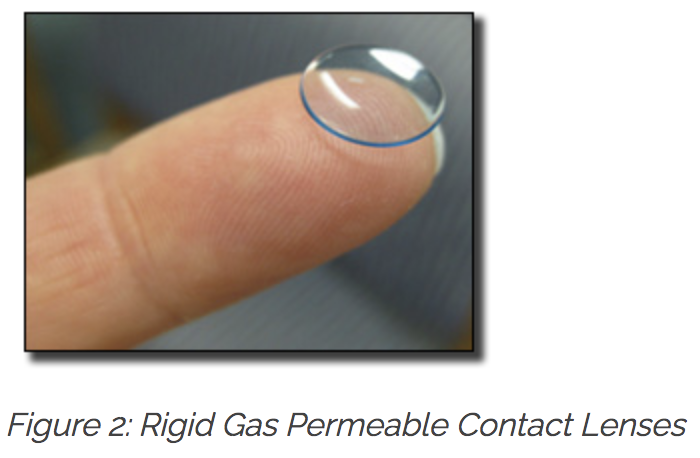 Keratoconus - OasisEye Specialists