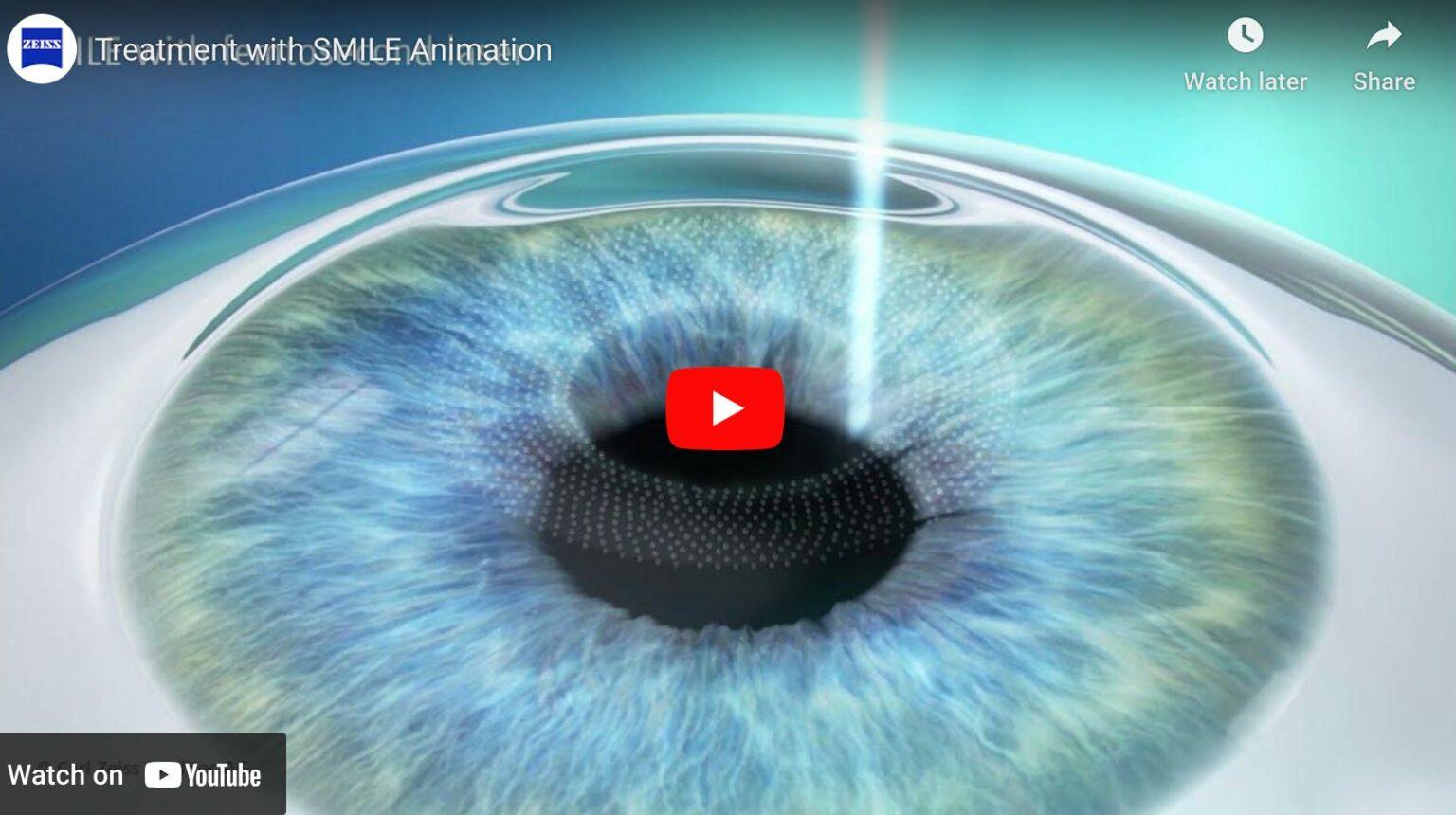 Expert Eye Specialist Services | Comprehensive Eye Care | OasisEye