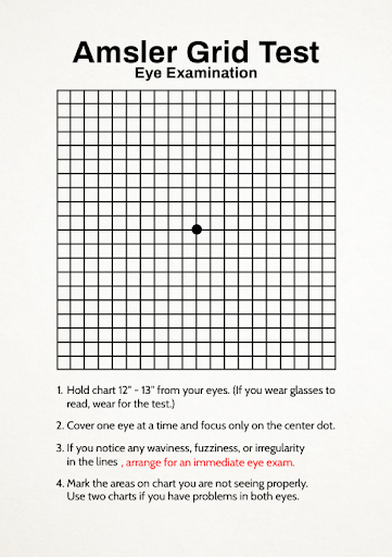 Age-related Macular Degeneration (AMD) | OasisEye Specialists